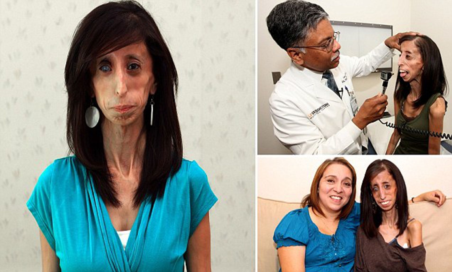 World’s Thinnest Woman Urges Fans Not to Follow Her Path Amid ...