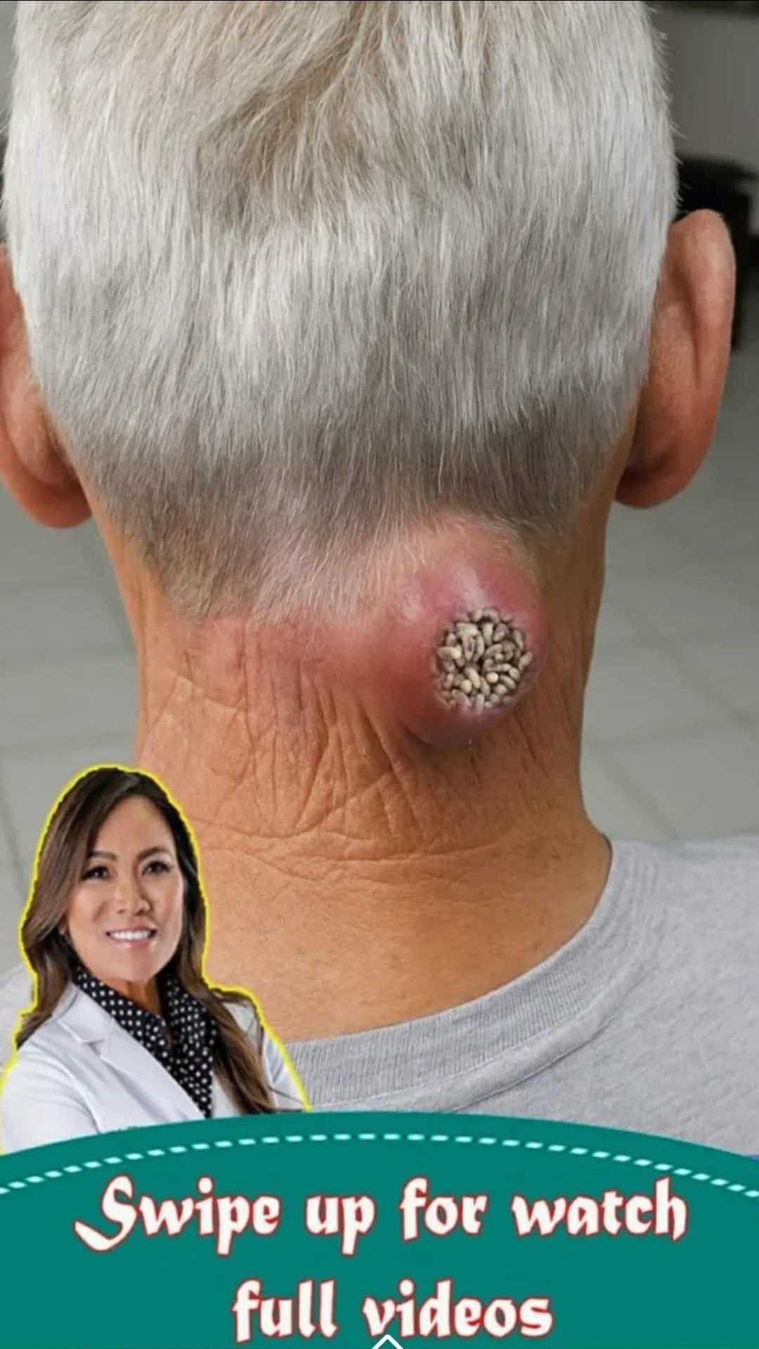 8 ALARMING SKIN SIGNS YOU CAN’T I – Story News